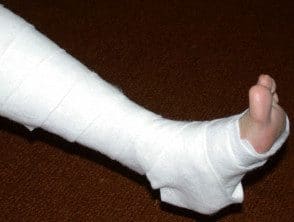 Compression therapy - Hoogstra - Medical Centers